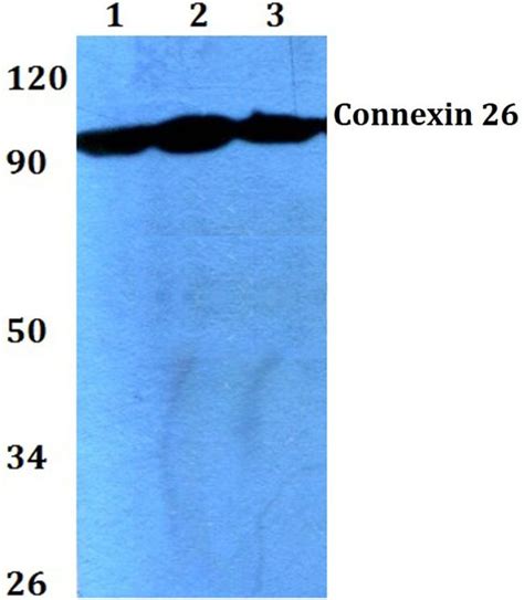 mGluR2/mGluR3 Antibody (PA5-36519)