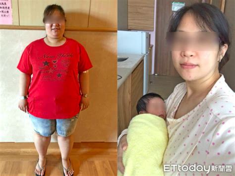 29歲女體重100kg「1年沒月經」婚後5年不孕 一年甩掉40kg順利產子！ Ettoday健康雲 Ettoday新聞雲