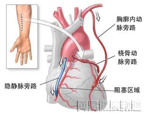 文章详情
