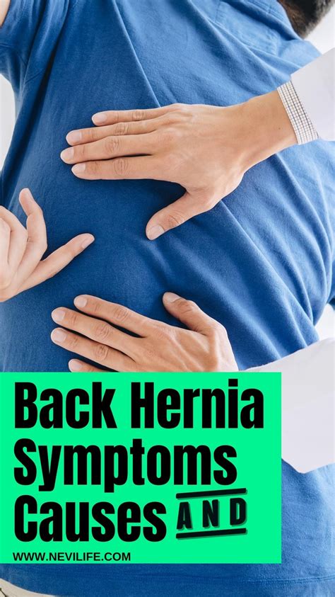 Lower Back Hernia Symptoms And Causes Glesspena Nevilife Artofit