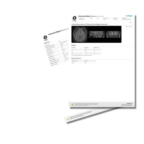 Automatic And Precise Aneurysm Detection