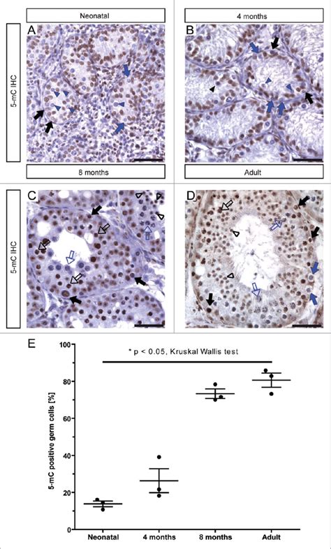 Global Dna Methylation Is Gradually Established In Germ Cells During