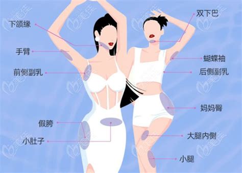 130斤抽脂瘦到90多少钱 水动力吸脂价格2 4万 威塑吸脂3 6万左右 美佳社区