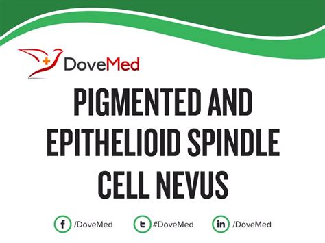 Pigmented And Epithelioid Spindle Cell Nevus Dovemed