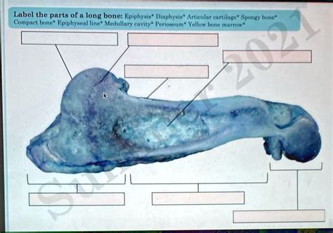 Solved Label The Parts Of A Long Bone Epiphysis Diaphysis Articular