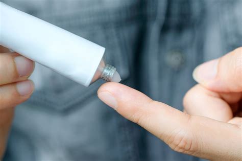 Eczema Psoriasis And Dermatitis Topical Steroids And Their Side Effec