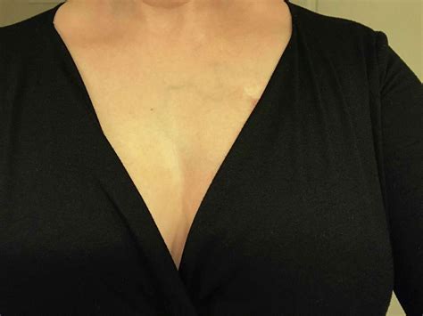 Boob Glue Not Quite The Uplifting Blessing I Hoped For