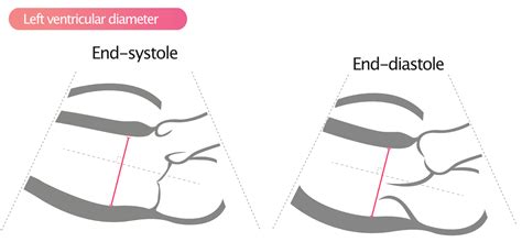 Standard Transthoracic Echocardiogram Complete Imaging Protocol Ecg And Echo