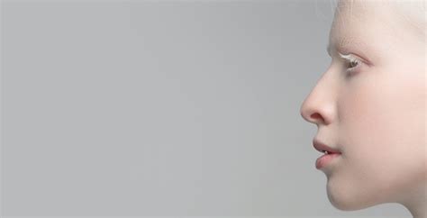 스튜디오 배경에 고립 된 아름다운 알비노 여성의 초상화를 닫습니다 아름다움 패션 스킨 케어 화장품 개념 세부 정보 알비노에 대한