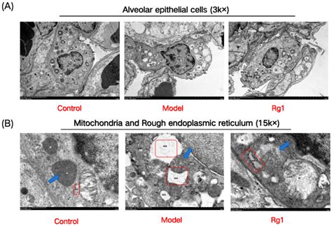 Ginsenoside Rg1 Prevents And Treats Acute Pulmonary Injury Induced By