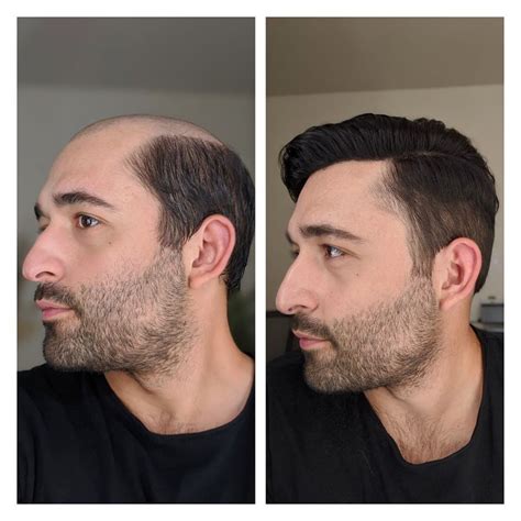 Men`s Human Wigs On Sale Hair Wigs For Men Hair Pieces Hair