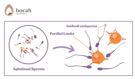 Sperm Agglutination On Male Fertility
