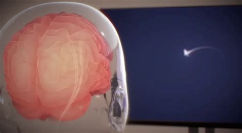 Neuralink Telepathy Chip What It Is And How It Works Root