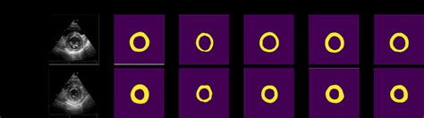 Visualization Results Of Four Segmentation Methods Download Scientific Diagram