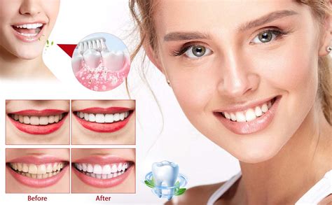 Buy Newclick Sp 4 Toothpaste Sp 4 Toothpastesp 4 Brightening