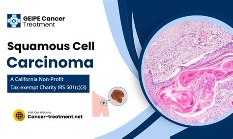 Scc Vs Bcc Whats The Difference