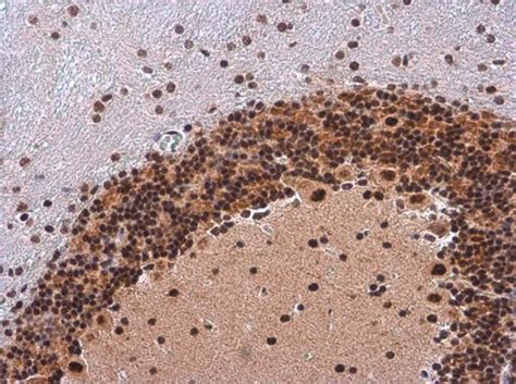 Phospho Irs1 Ser307 Polyclonal Antibody Invitrogen 100 μl
