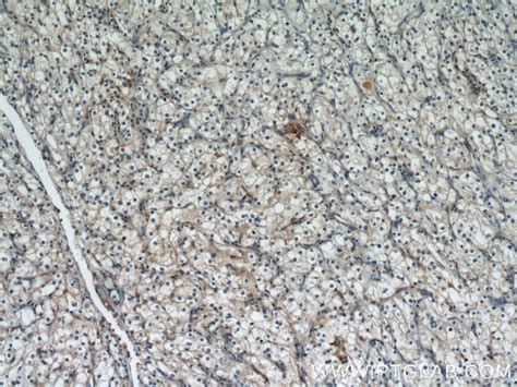 Anti Beta 2 Microglobulin Antibodies Invitrogen