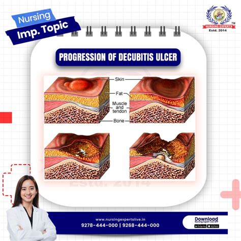 Nursing Experts Posted On Linkedin