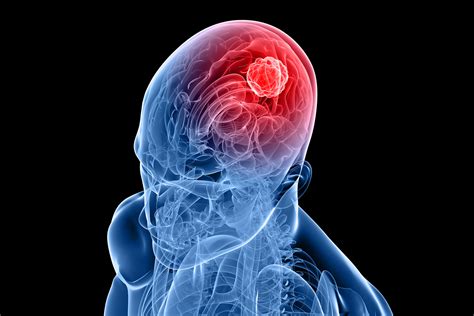 Breakthrough Blood Test Developed For Brain Tumors — Harvard Gazette