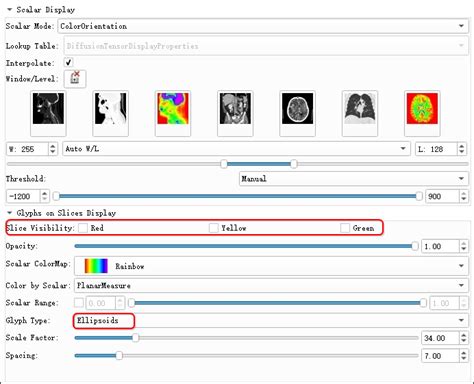 Dti教程06 弥散张量的可视化 Dti 3dslicer中文论坛