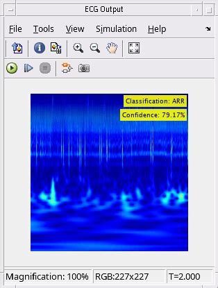 Code Generation For A Deep Learning Simulink Model To Classify Ecg