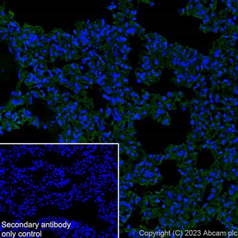 Anti Rage Antibody Rm1078 Ab314773 Abcam