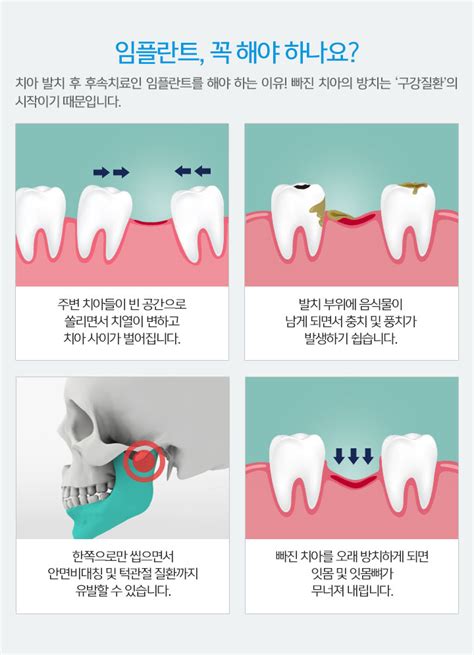 서울화이트치과