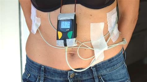 Holter Monitor Ecg Healthcare Medical And Technology Industry Stock