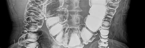 Fluoroscopy Alfred Health