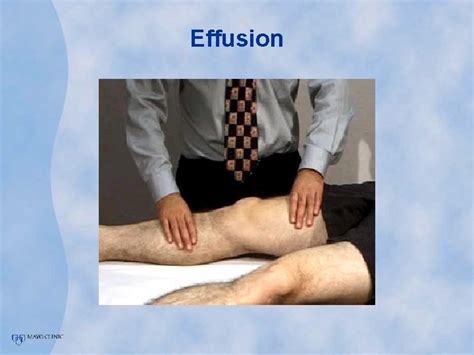 Joint Effusion Treatment