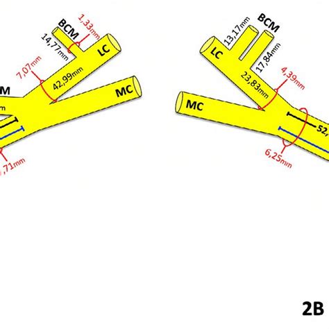 Scheme Of The Nerve Distribution In The Arm In A The Right Side And Download Scientific
