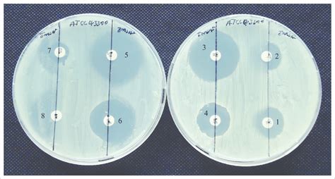 Antibiogram Test Of S Aureus Isolate The Isolate Was Resistant To