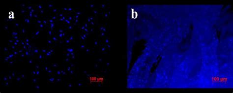 Fluorescence Microscopy Demonstrating Dapi Stained Human Osteoblasts