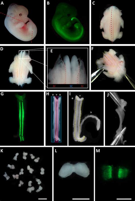 Embryonic Spinal Cord Dissection And Ventral Spinal Cord Explant