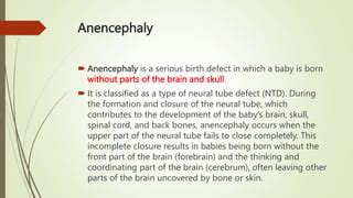 Congenital Anomalies Of Nervoussystempptx