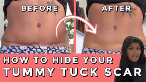 Covering Up My Tummy Tuck Scar Using Body Makeup To Really Hide My