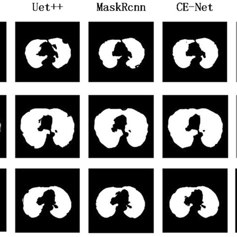 the segmentation results on lung dataset from left to right original