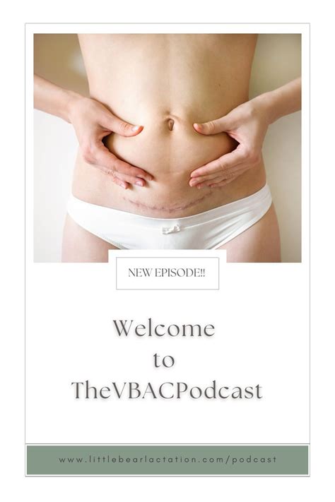 Vaginal Birth After Cesarean Vbac Artofit