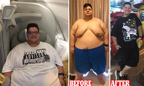 Morbidly Obese Boy