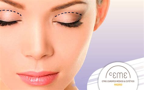5 Razones para realizar una Blefaroplastia o cirugía de párpados Ceme