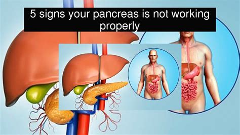 5 Signs Your Pancreas Is Not Working Properly YouTube