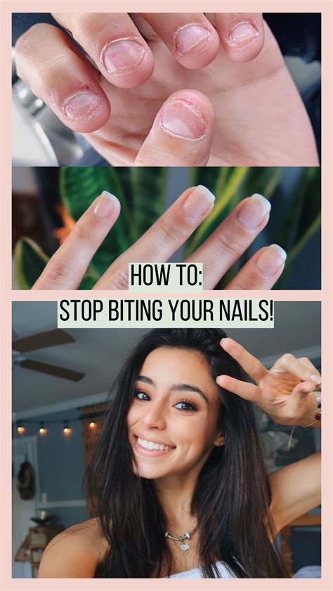 Tips To Break The Nail Biting Habit