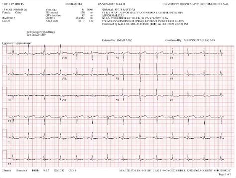 ECG Demonstrating Normal Sinus Rhythm With No Acute Pathology