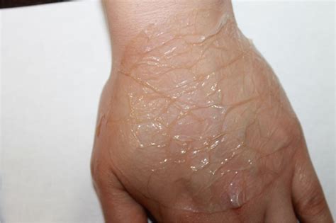 Transparency Of Microbial Cellulose Honey Sheet Download Scientific