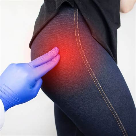Expert Physiotherapy For Hip Pain And Groin Pain