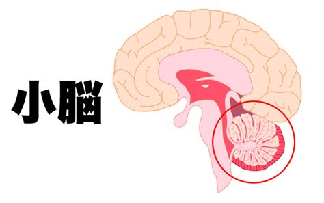 運動失調症に対するリハビリ 再生医療大阪脳梗塞・脊髄損傷後遺症の幹細胞治療ニューロテックメディカル