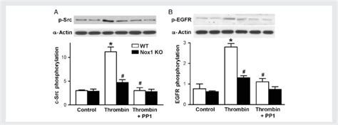 Thrombin Induced EGFR Transactivation Is Mediated By C Src