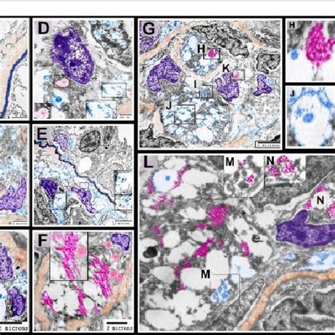 Maturation And Rupture Of Rodlet Cells Colored Electron Micrographs