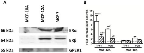 A ERα ERβ and GPER expression detected by immunoblotting B Download Scientific Diagram